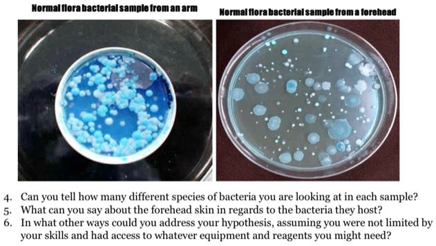 SOLVED: Normal flora bacterial sample from an arm Normal bacterial ...