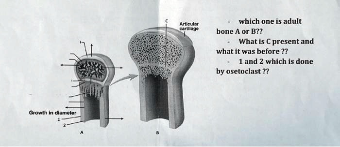 SOLVED: Articular cartilage Which one is adult bone, A or B? What is C ...
