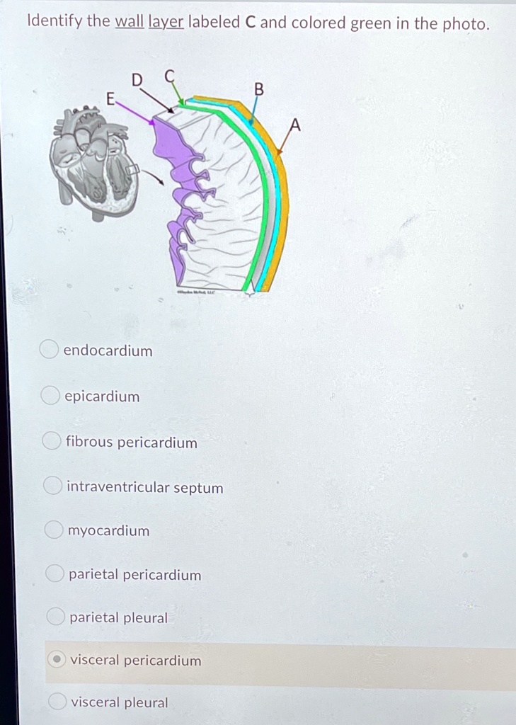 SOLVED: Anatomy 2112 Identify the wall layer labeled C and colored ...