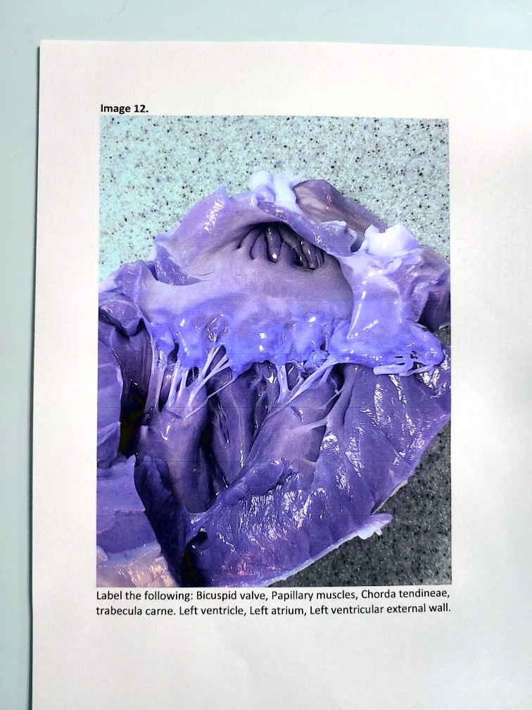 Image 12. Label the following: Bicuspid valve, Papillary muscles ...