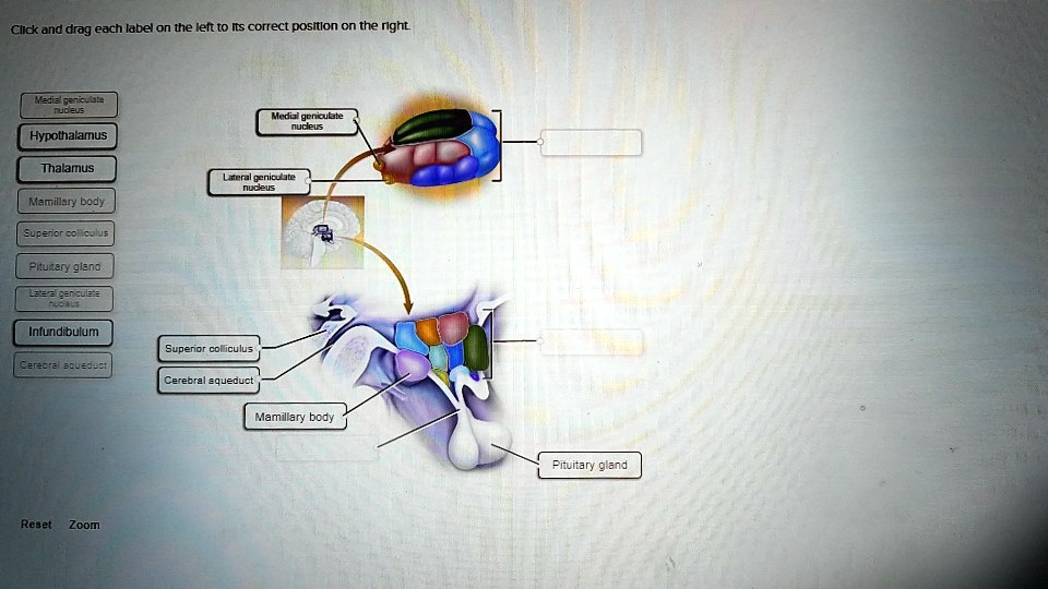SOLVED: Click and drag each label on the left to its correct position on the right. Ua Force ...