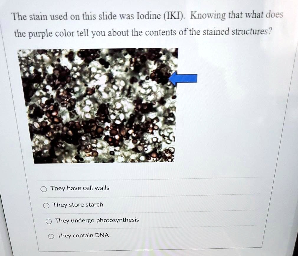 the stain used on this slide was iodine iki knowing that what does the ...