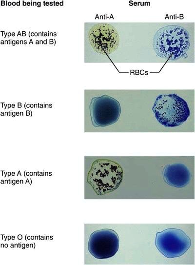 SOLVED: View the blood typing slides in Figure 29.7 (a) in your ...