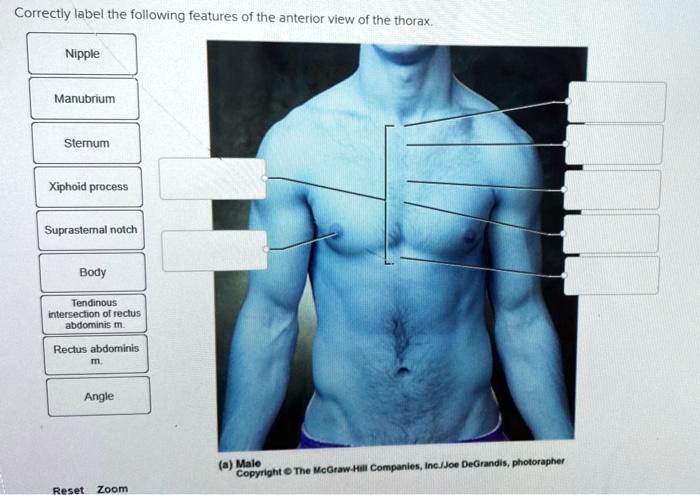 Correctly label the following features of the anterior view of the ...