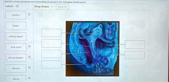 SOLVED: Label the urinary structures and surrounding structures in the ... SOLVED: Label the urinary structures and surrounding structures in the ...