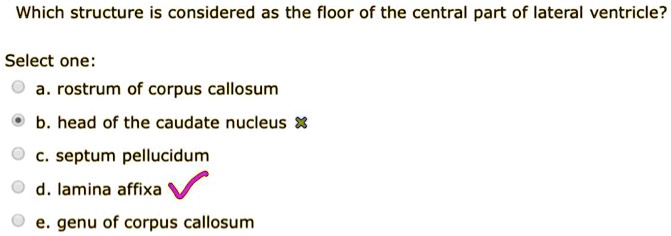 SOLVED: Which structure is considered as the floor of the central part ...