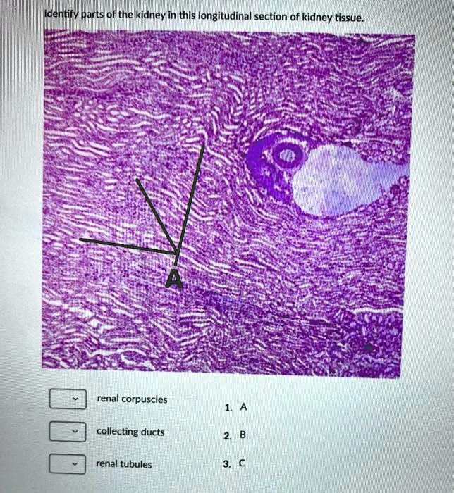 SOLVED: Identify parts of the kidney in this longitudinal section of ...