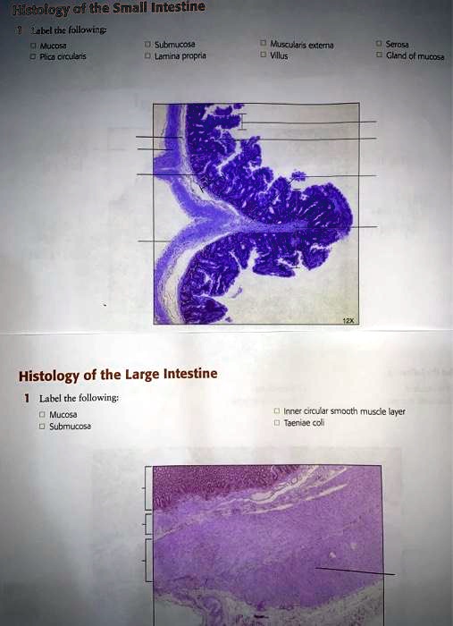 Histology of the Small Intestine: The following are the layers of the ...