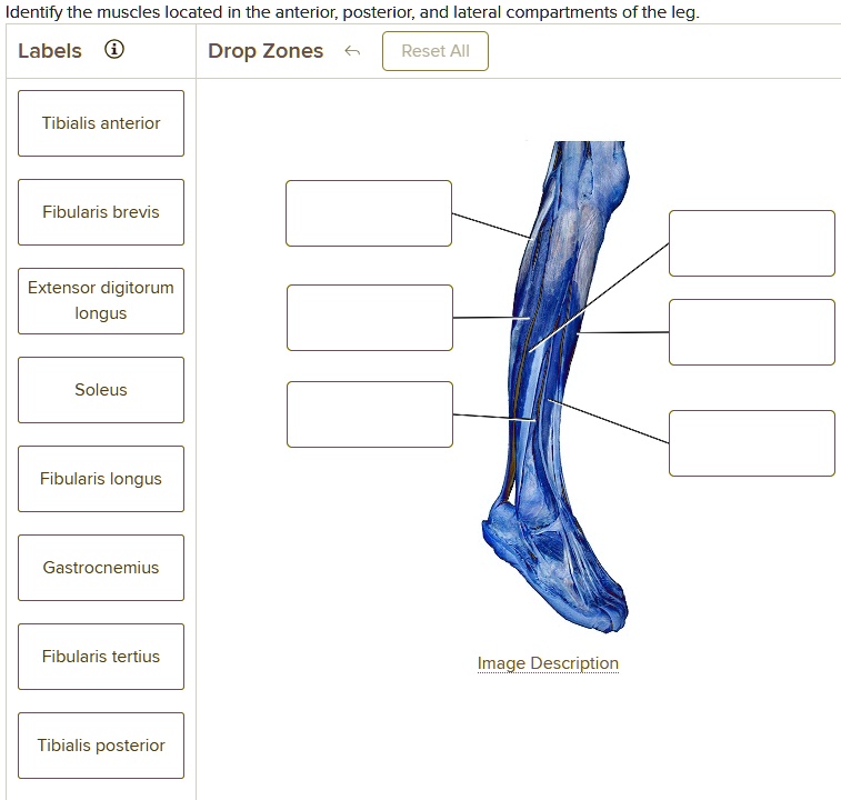 Identify the muscles located in the anterior, posterior, and lateral ...