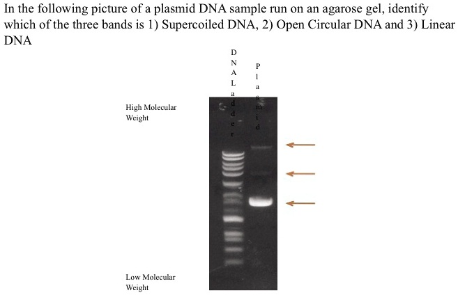 In the following picture of a plasmid DNA sample run on an agarose gel ...