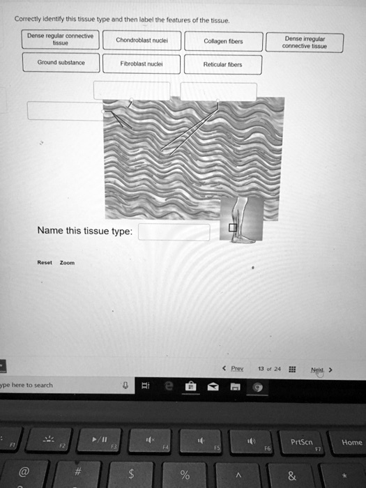 SOLVED: Correctly identify this tissue type and then label the features ...
