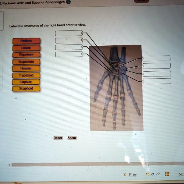 Pectoral Girdle and Superior Appendages Label the structures of the ...