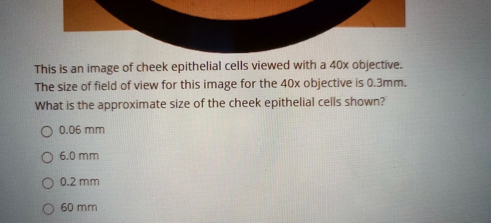 this is an image of cheek epithelial cells viewed withia 40x objective the size of field of view ...