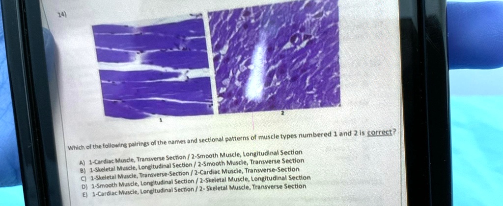 SOLVED: The correct answer is C) 1-Skeletal Muscle, Transverse-Section ...