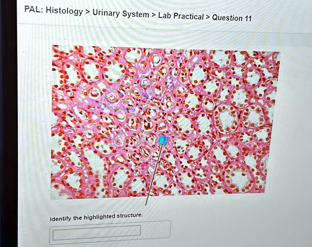 PAL: Histology > Urinary System > Lab Practical > Question 11 Identify ...