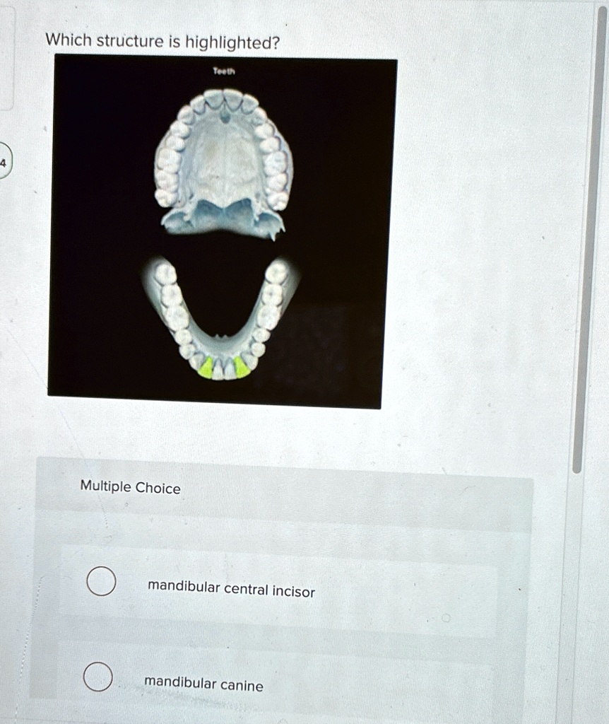 Which structure is highlighted? Multiple Choice mandibular central ...