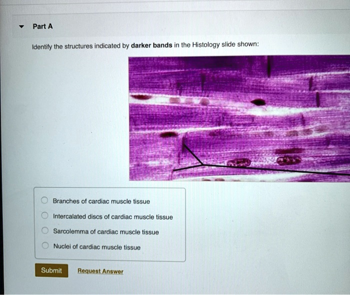 VIDEO solution: Identify the structures indicated by darker bands in ...