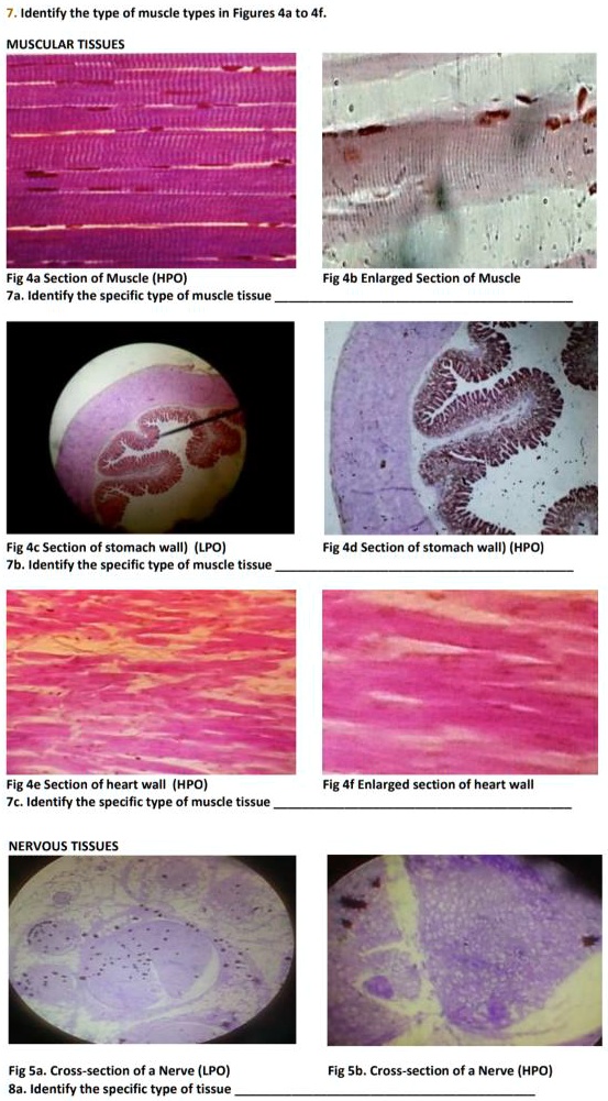 SOLVED: Text: Identify the types of muscle tissue in Figures 4a to 4f ...