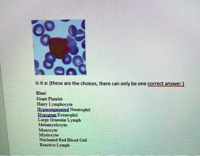 SOLVED: @ Is it a; (these are the choices, there can only be one ...