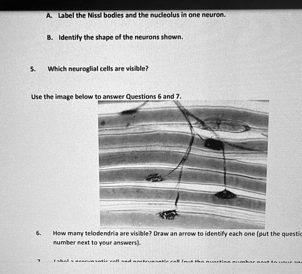 VIDEO solution: A. Label the Nissl bodies and the nucleolus in one ...