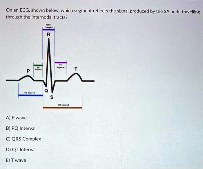 SOLVED:On an ECG, shown below; which segment reflects the signal ...