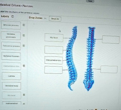 Label the structures of the vertebral column Labels Articular process ...