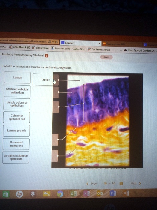 Label the tissues and structures on the histology slide Amazon.com ...