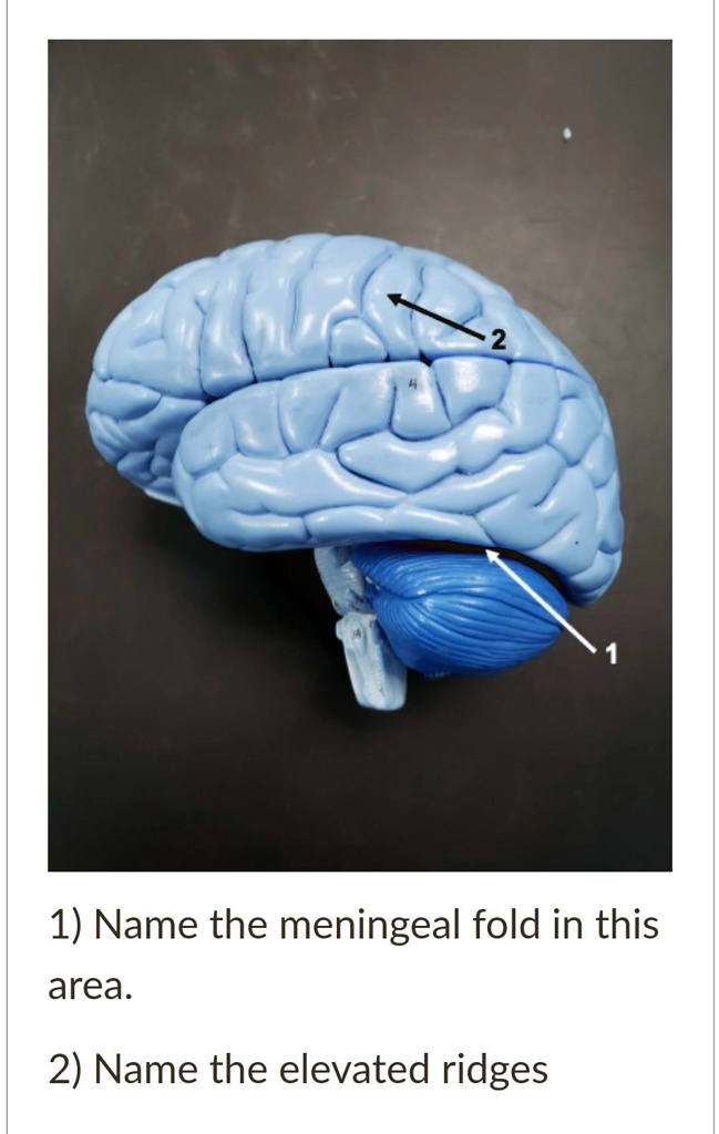 SOLVED:1) Name the meningeal fold in this area: 2) Name the elevated ...