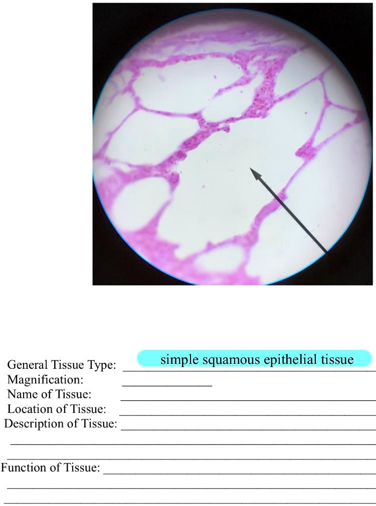 General Tissue Type: simple squamous epithelial tissue Magnification ...
