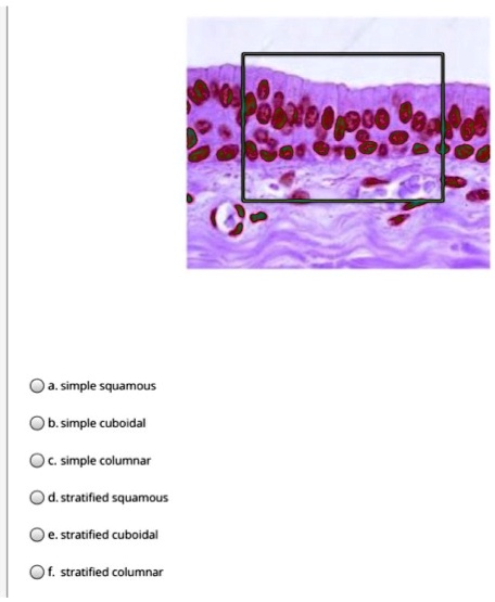 SOLVED: 7900 C8 63 a. simple squamous b. simple cuboidal c. simple columnar d. stratified ...