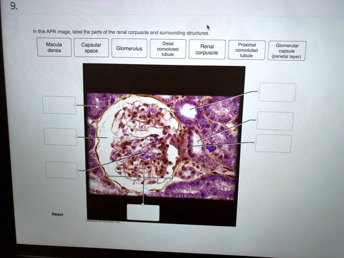 SOLVED: In this APR image, label the parts of the renal corpuscle and surrounding structures 9 ...