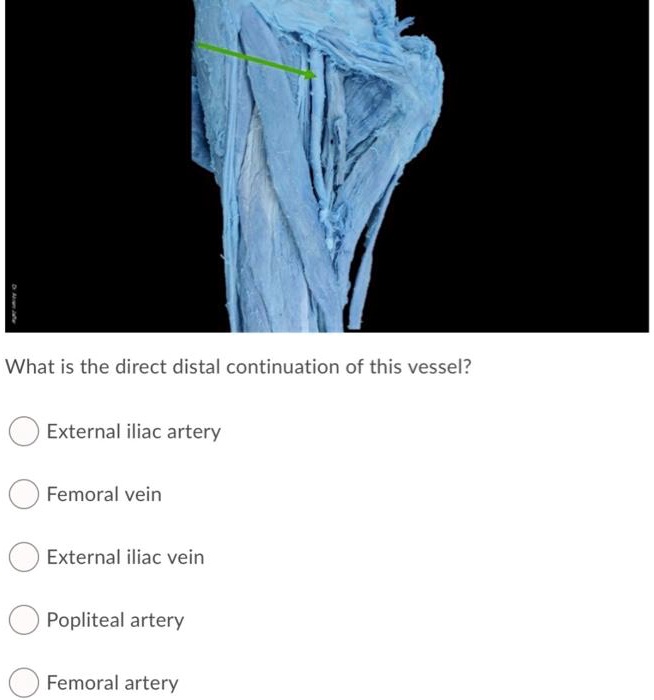 What is the direct distal continuation of this vessel? External iliac ...