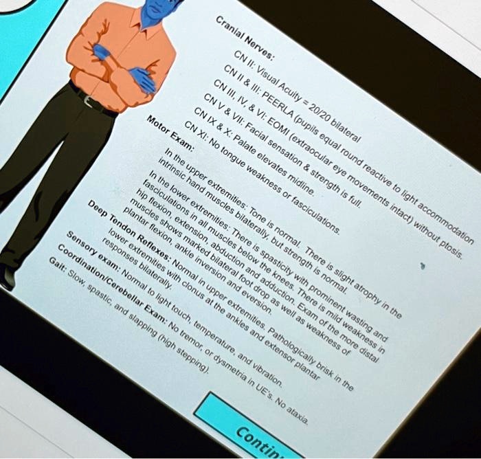 Cranial Nerves: CN II: Visual Acuity = 20/20 bilateral CN II III ...