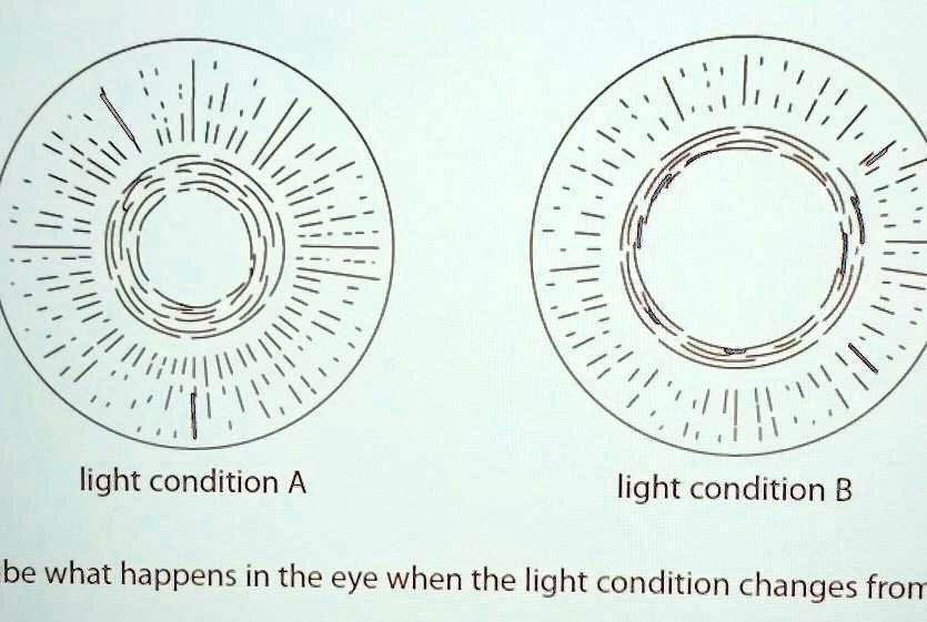 SOLVED: The diagram shows the iris of an eye in two different light ...