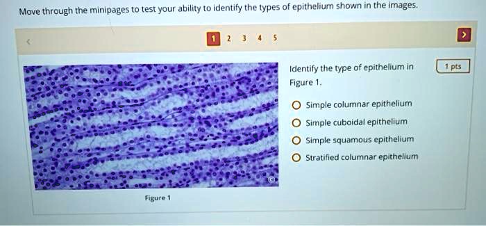 identify the type of epithelium in figure 1 Move through the minipages ...