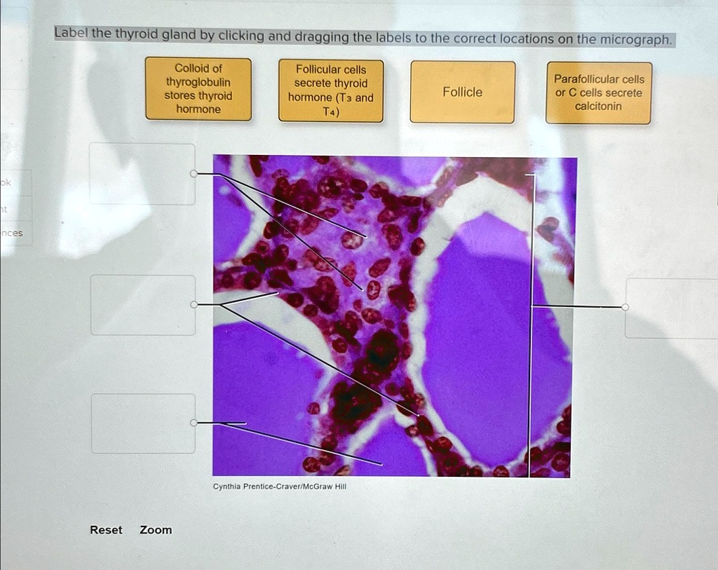 SOLVED: Label the thyroid gland by clicking and dragging the labels to ...