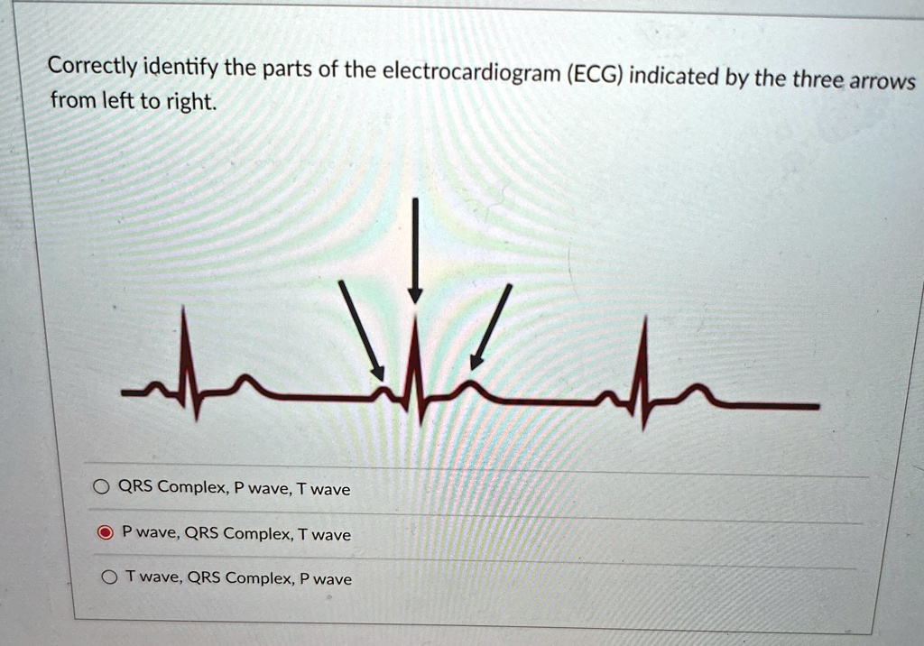correctly identify the parts of the electrocardiogram ecg indicated by ...
