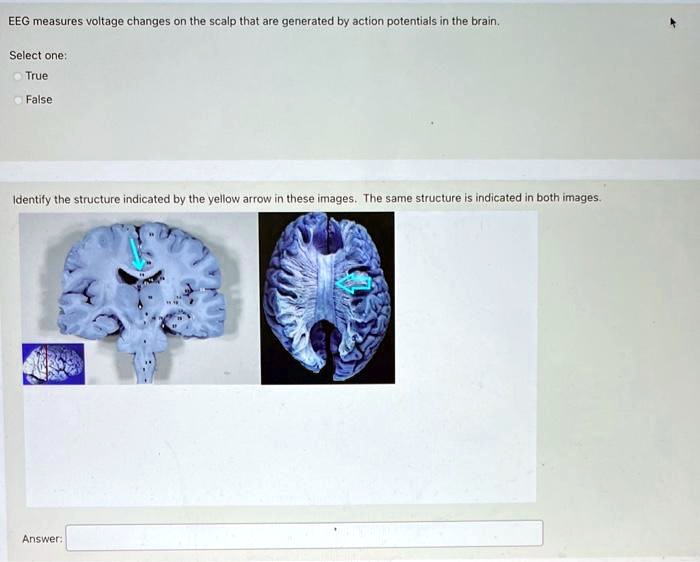 SOLVED: EEG measures voltage changes on the scalp that are generated by ...