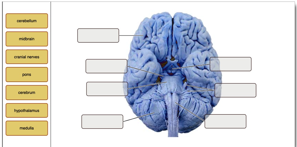 SOLVED: Label the parts of the brain that can be seen in this inferior ...