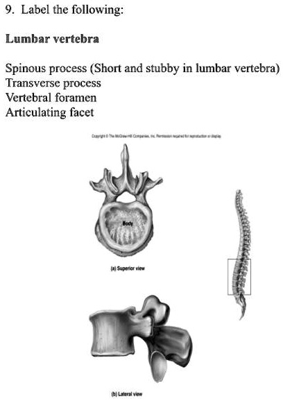 SOLVED: Label the following: Lumbar vertebra Spinous process (Short and ...