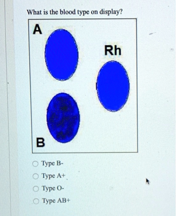SOLVED: What is the blood type on display? A Rh B Type B- Type A+ Type ...