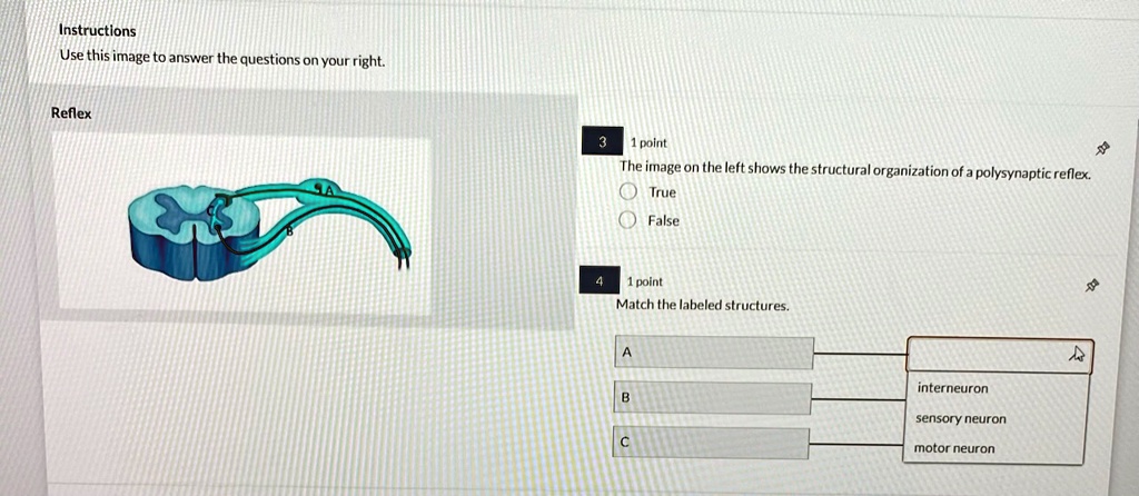 Instructions Use this image to answer the questions on your right. Reflex 3 1 point The image on ...