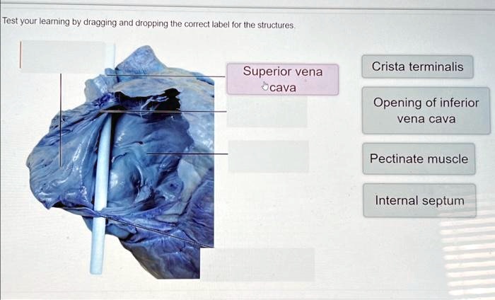 test your learning by dragging and dropping the correct label for the ...