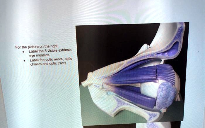 SOLVED: For the picture on the right, label the 5 visible extrinsic eye ...