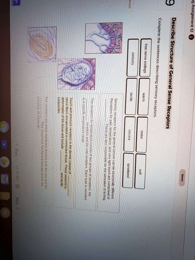 SOLVED: Assignment 12: Sensory Free Nerve Endings Complete the ...