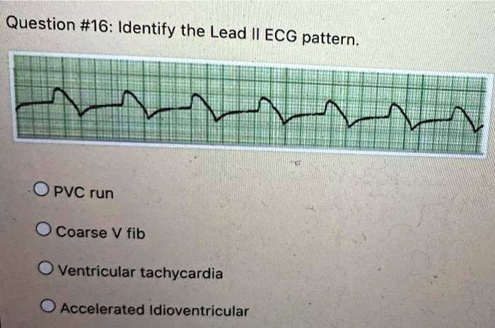 question 16 identify the lead ii ecg pattern pvc run coarse v fib ventricular tachycardia ...