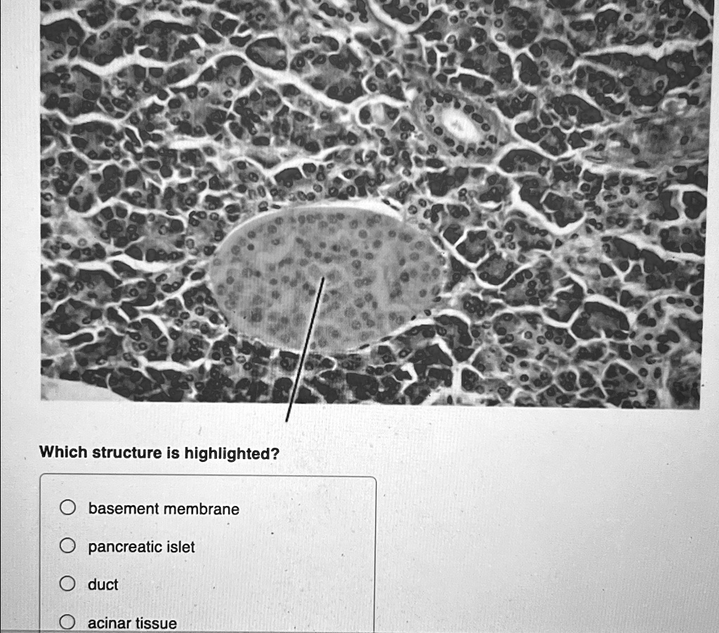 which structure is highlighted basement membrane pancreatic islet duct ...