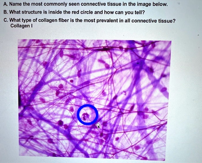A. Name the most commonly seen connective tissue in the image below. B ...