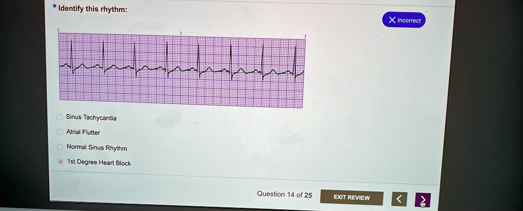 identify this rhythm sinus tachycardia atrial flutter normal sinus ...