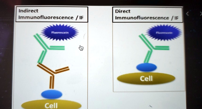 SOLVED: Indirect Immunofluorescence IF Direct Immunofluorescence / IF ...